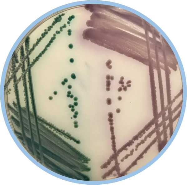 وبلاگ – ایبرسکو