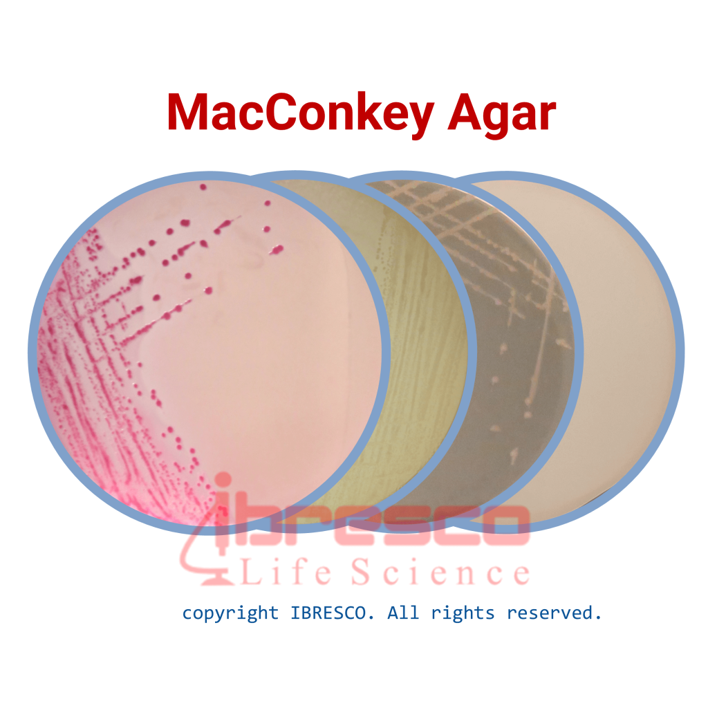 MacConkey Agar | ibresco
