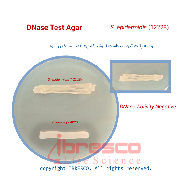 DNase test agar | دی ان ایز تست آگار | ایبرسکو