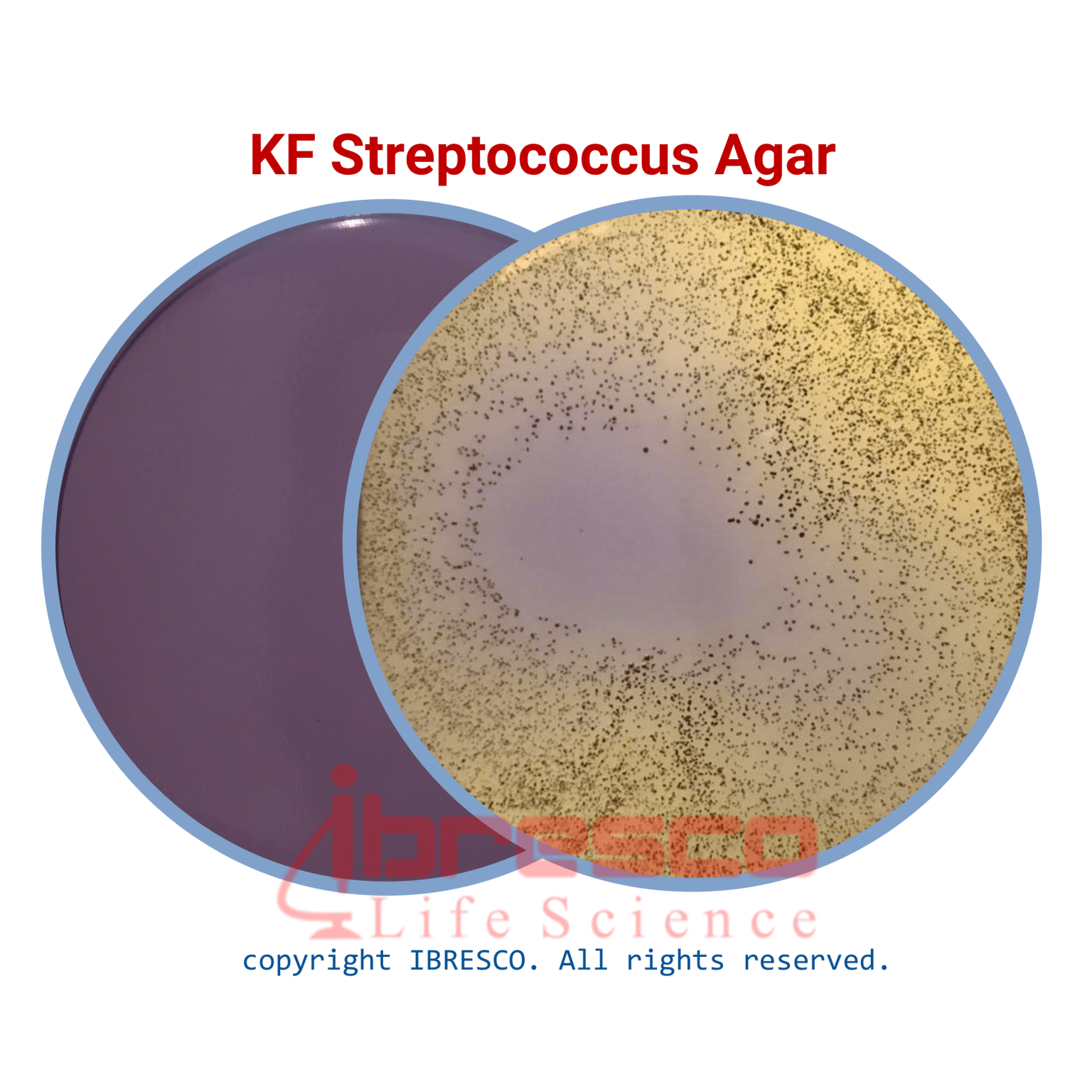 KF Streptococcus Agar | ibresco