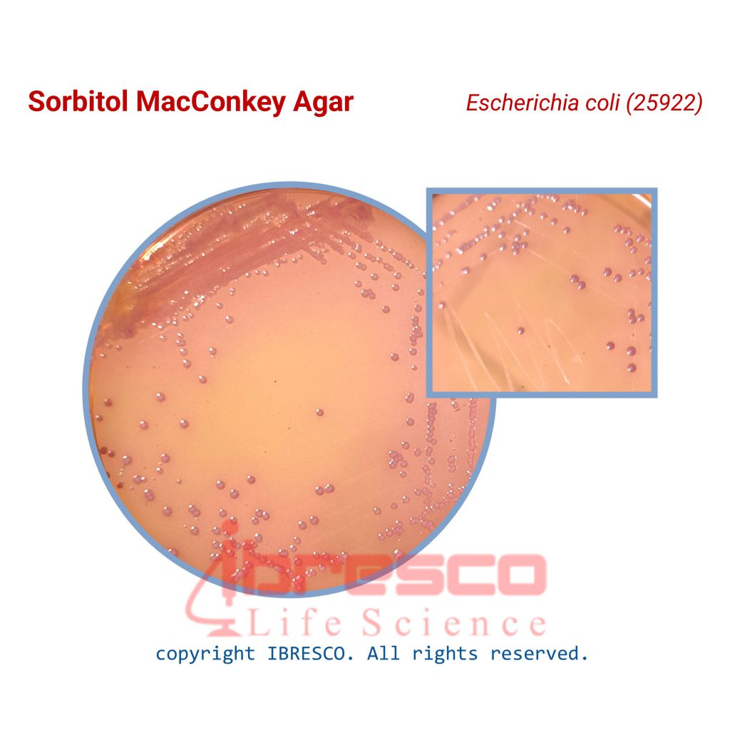 MacConkey Agar with Sorbitol, SMAC Agar | مک کانکی آگار با سوربیتول ...
